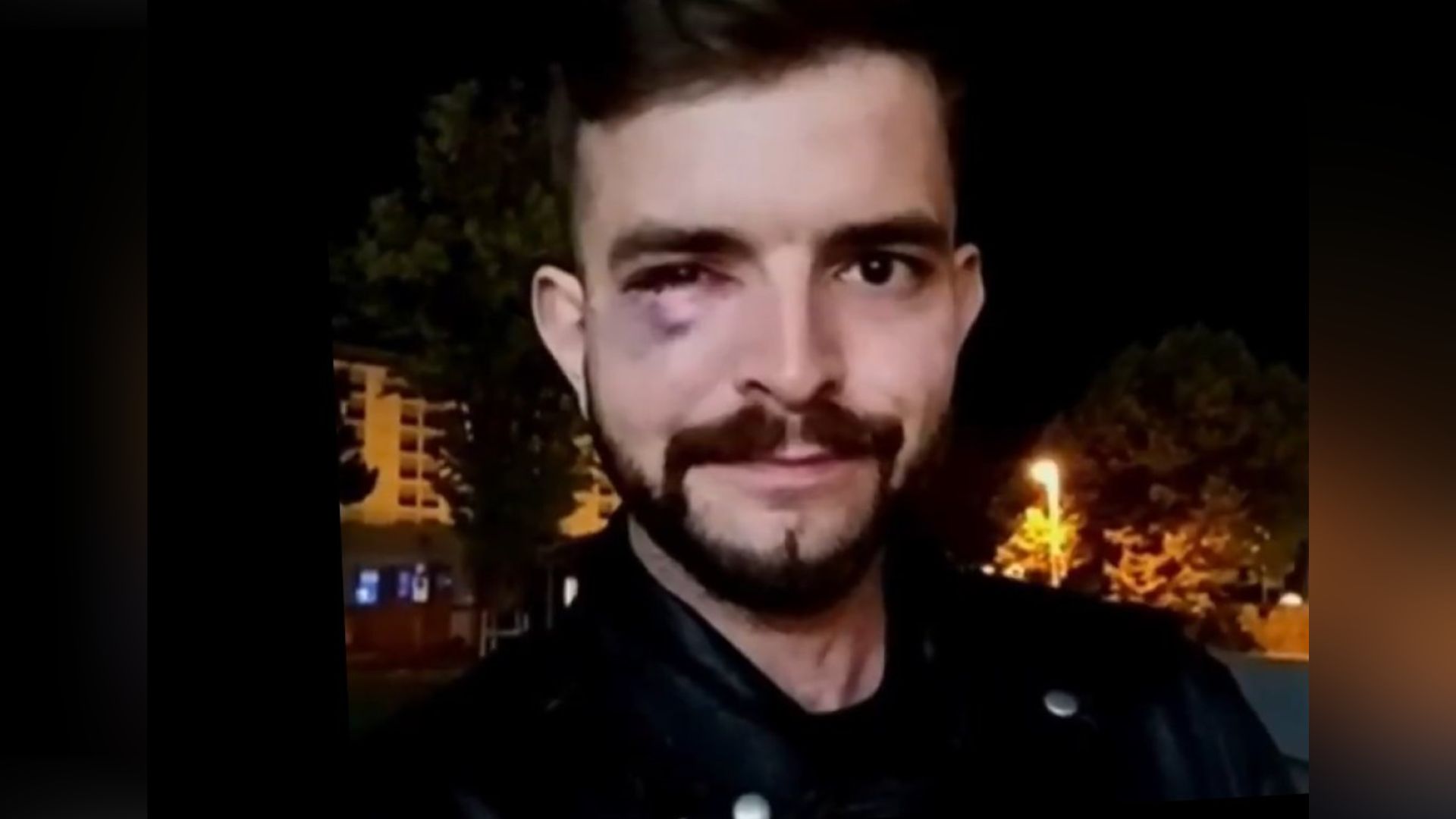 La APM y la FAPE condenan la agresión 'abertzale' a un periodista de 'El Español' en la ...